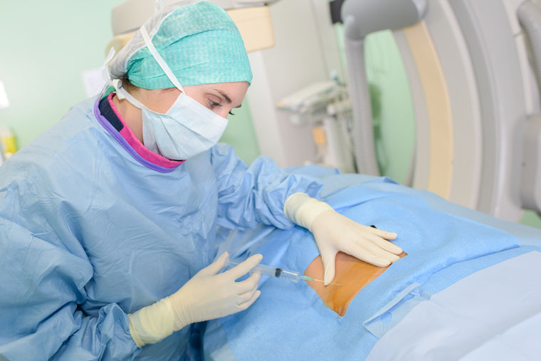 What You Should Know About Spinal Injections for Back Pain | Ortho Blog